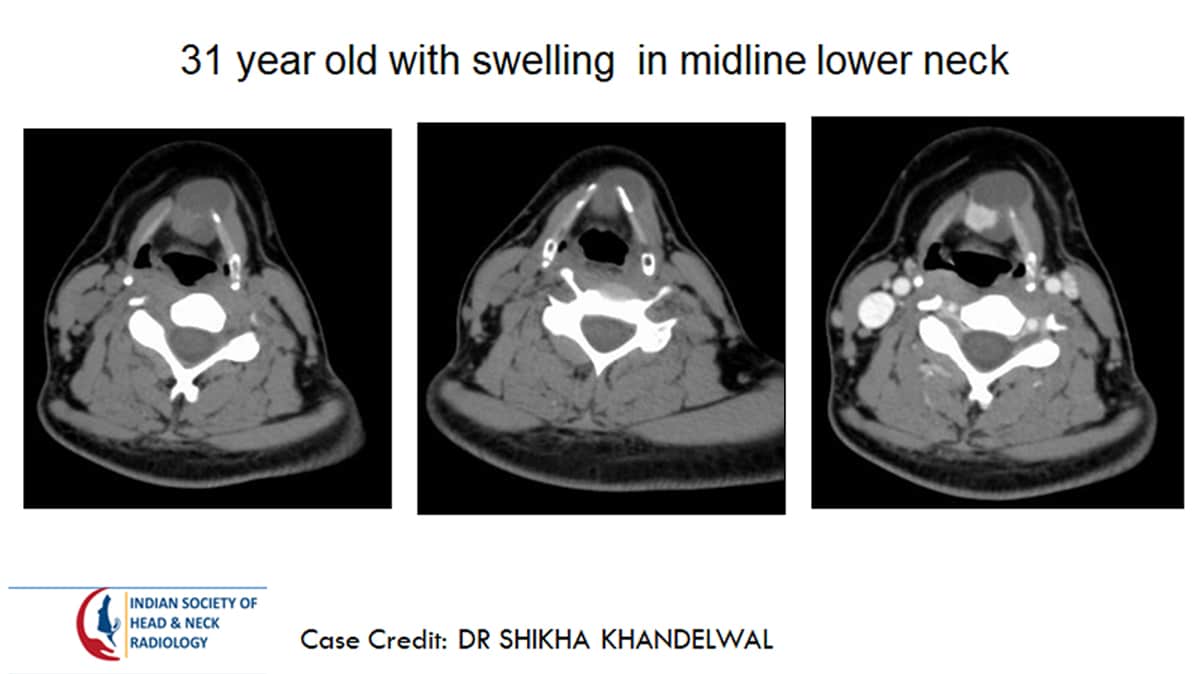 ISHNR Case of the Week