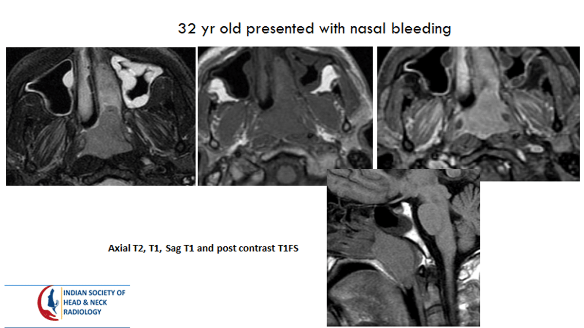 ISHNR Case of the Week