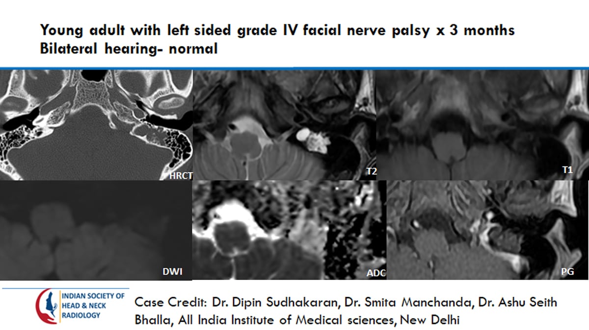 ISHNR Case of the Week