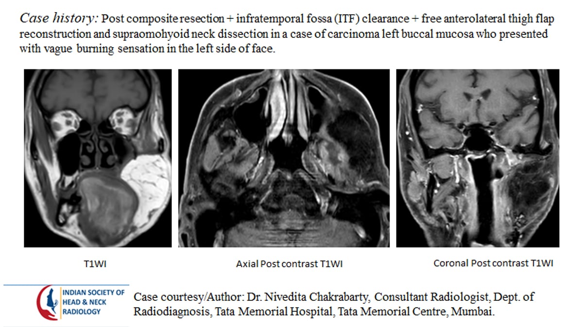 ISHNR Case of the Week
