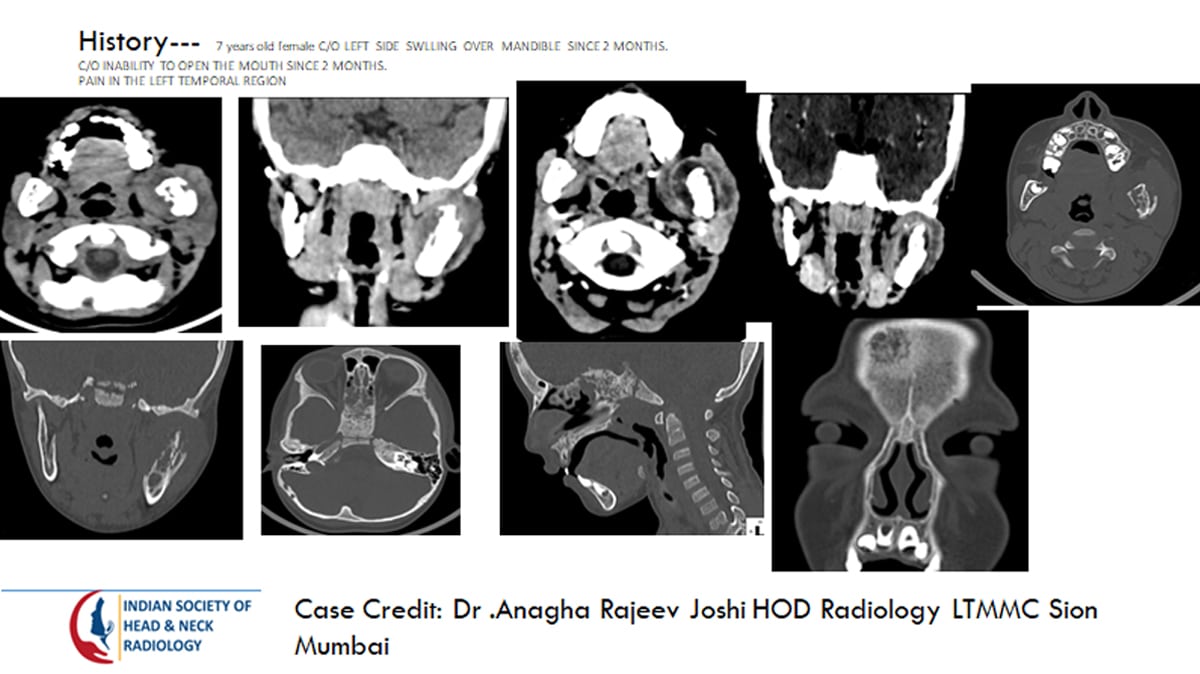 ISHNR Case of the Week