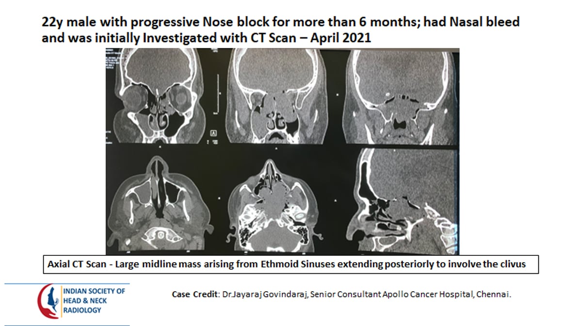 ISHNR Case of the Week