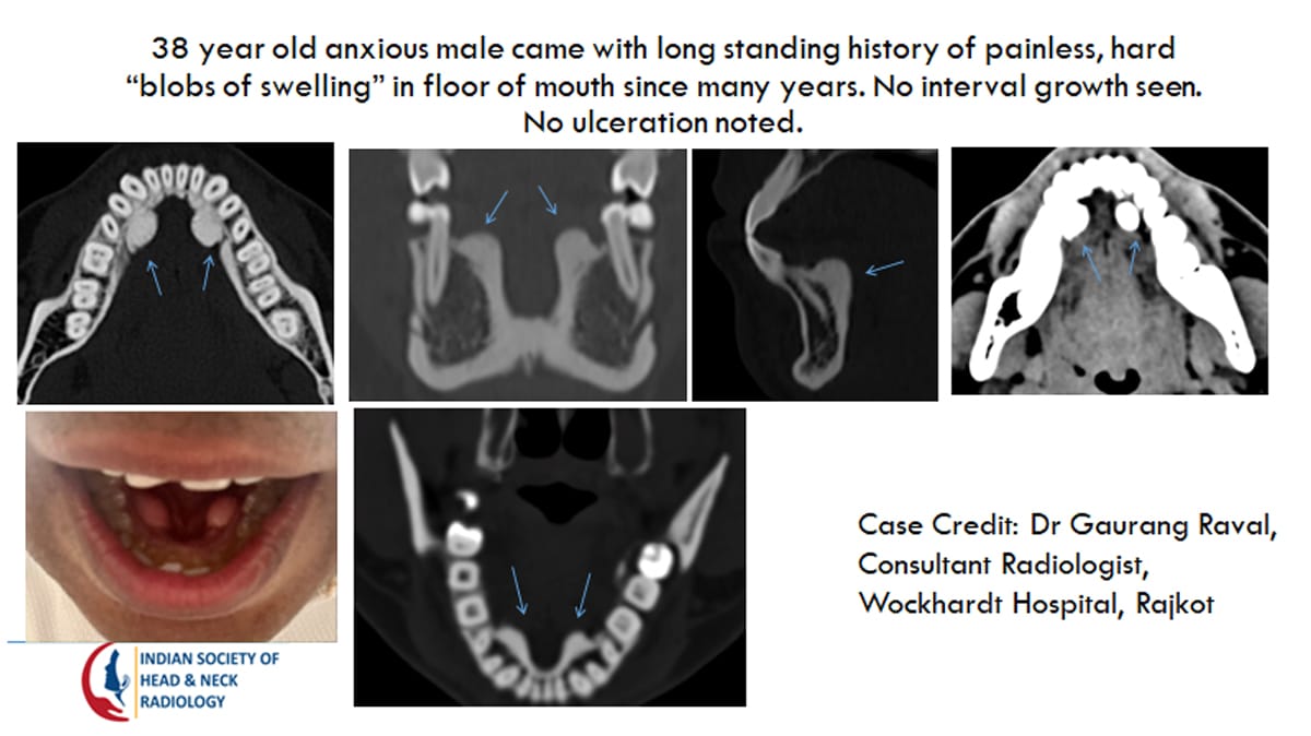 Case 19 - ISHNR