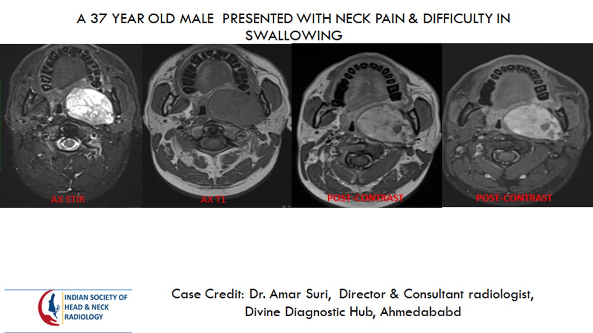 ISHNR Case of the Week
