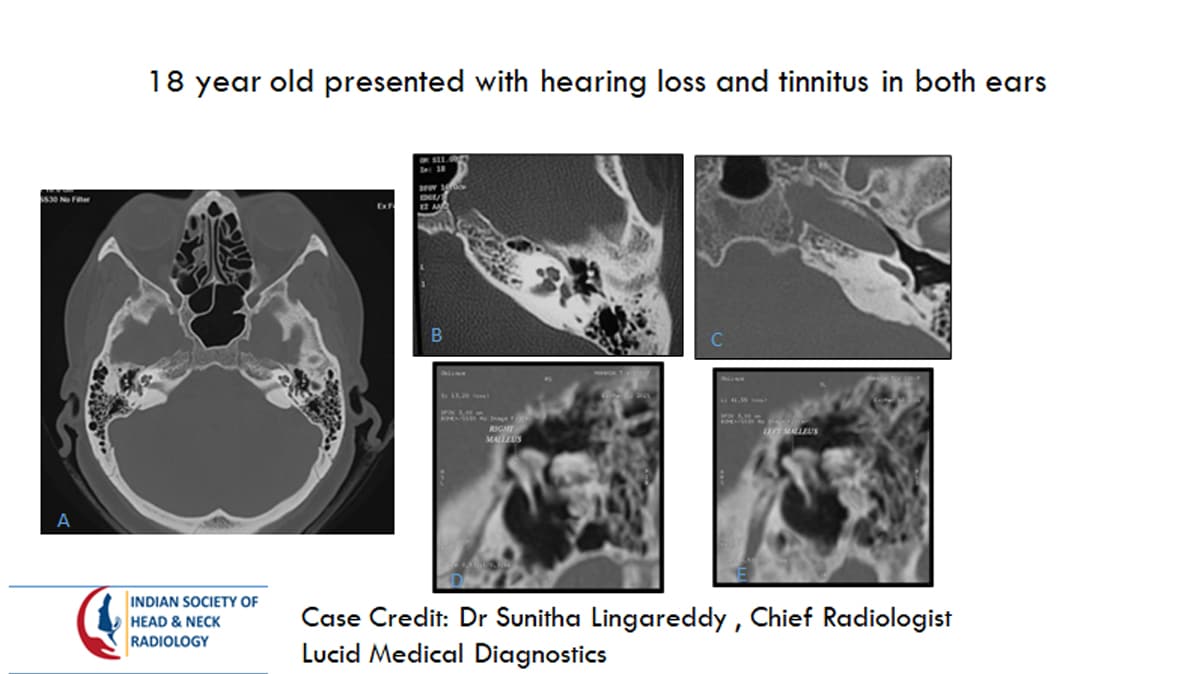 ISHNR Case of the Week
