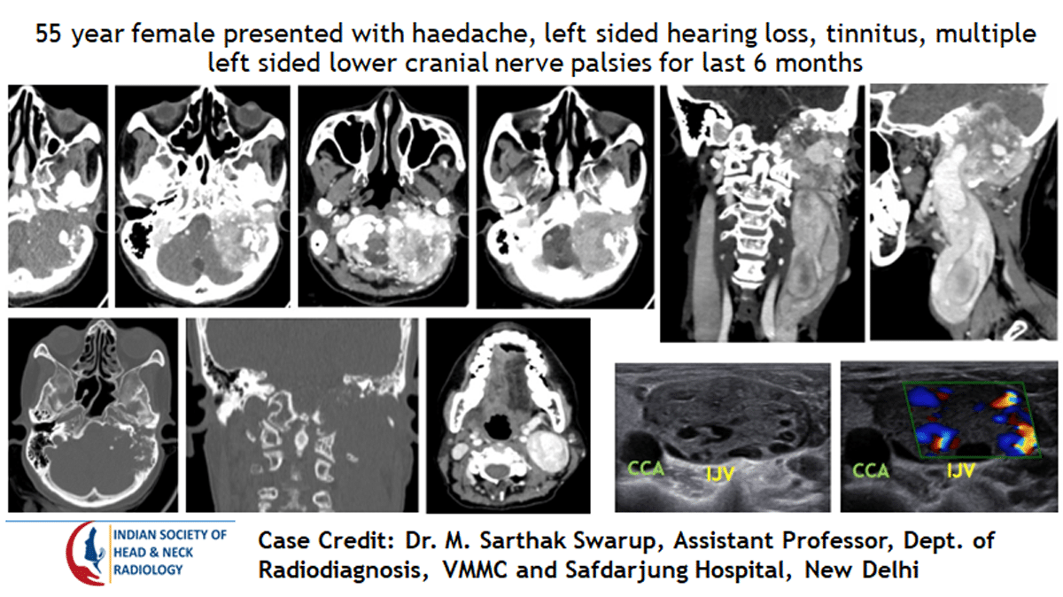 ISHNR Case of the Week