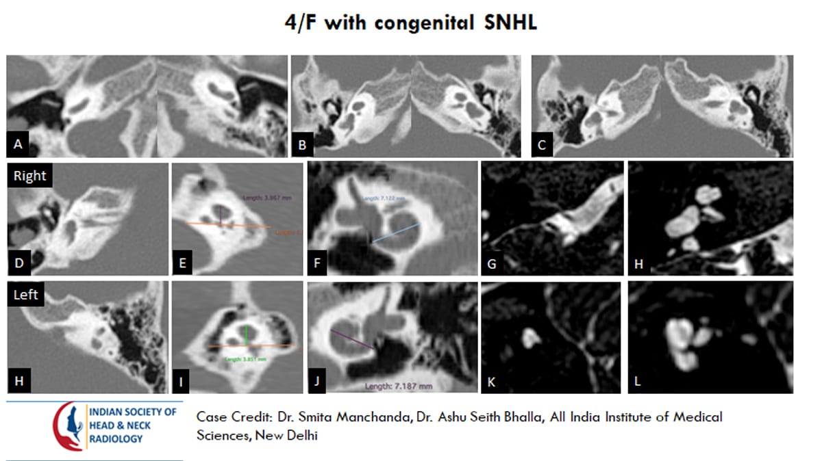 ISHNR Case of the Week