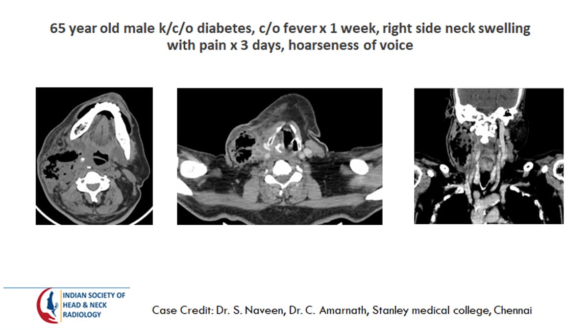 ISHNR Case of the Week