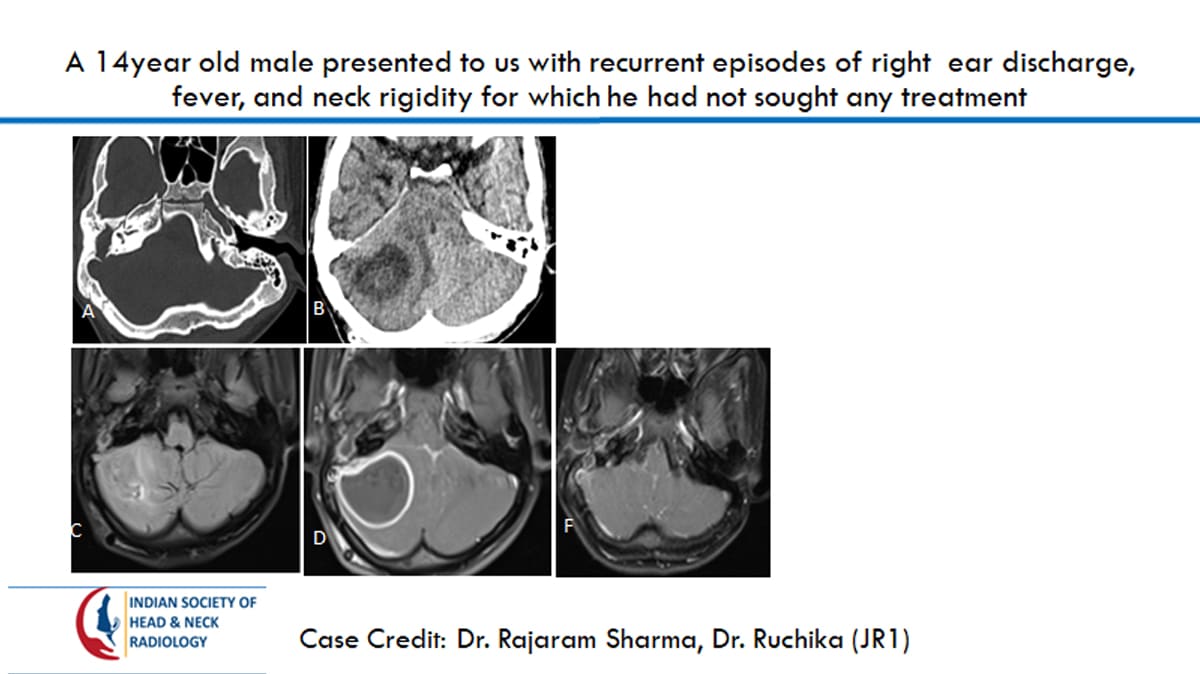 ISHNR Case of the Week