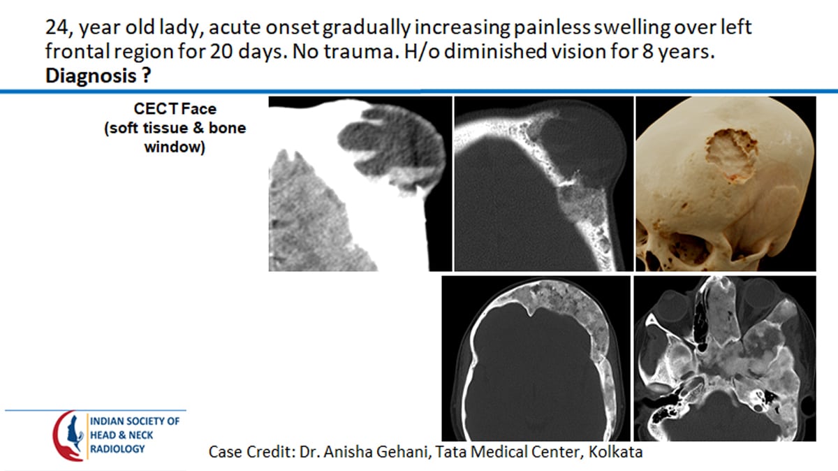 ISHNR Case of the Week