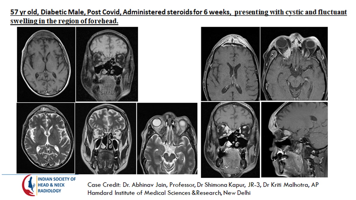 ISHNR Case of the Week