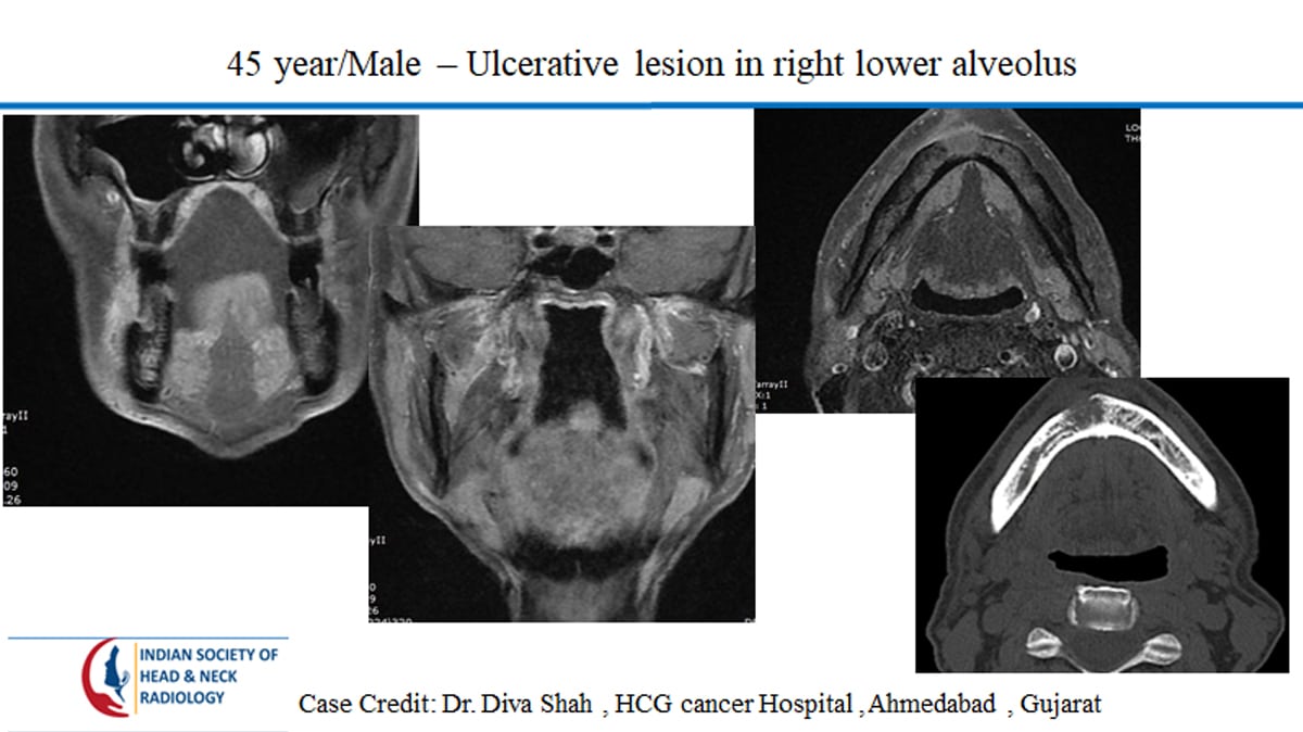 ISHNR Case of the Week