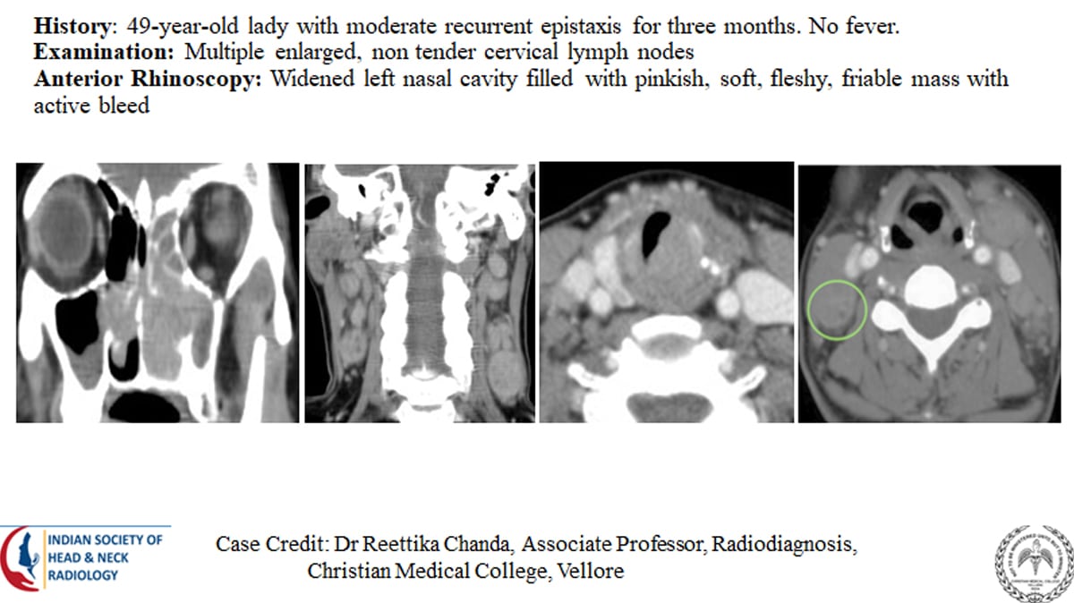ISHNR Case of the Week