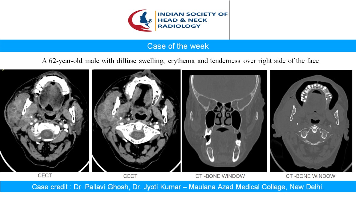 ISHNR Case of the Week