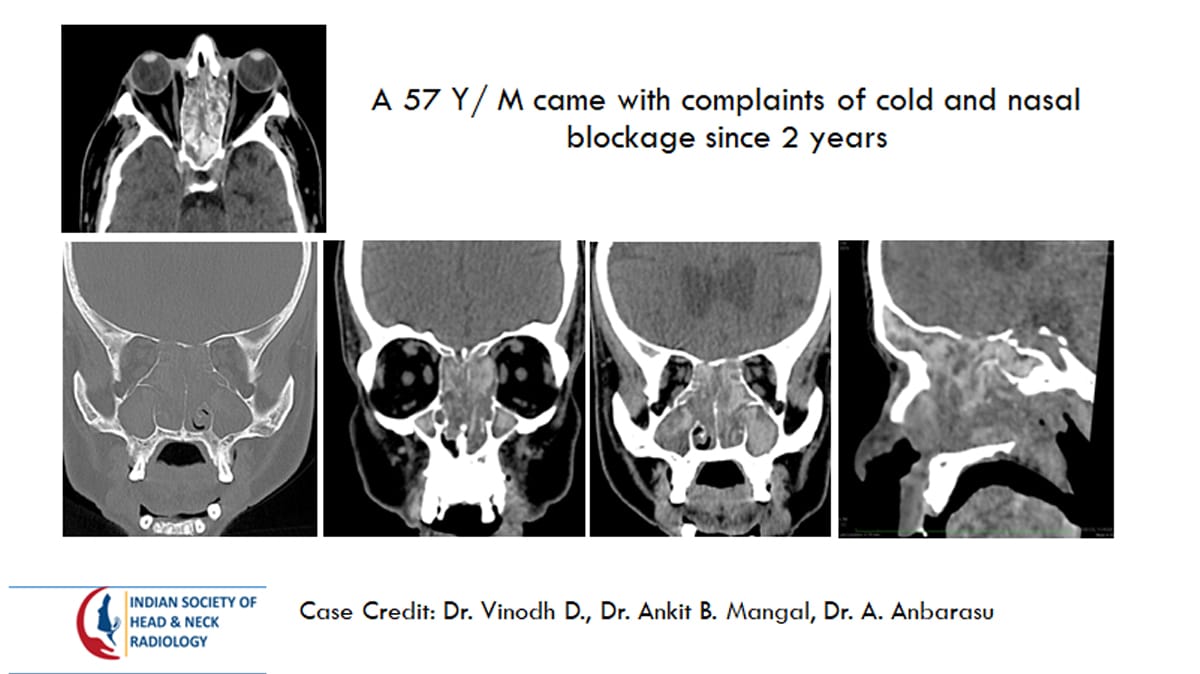 ISHNR Case of the Week