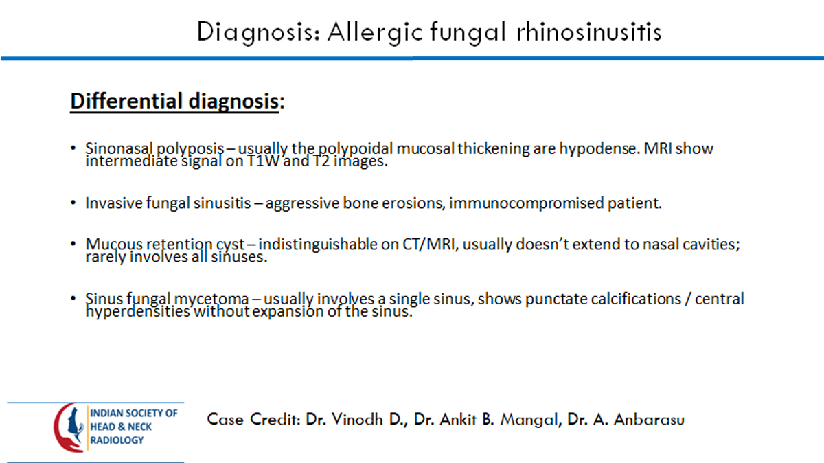 Case 44 - ISHNR