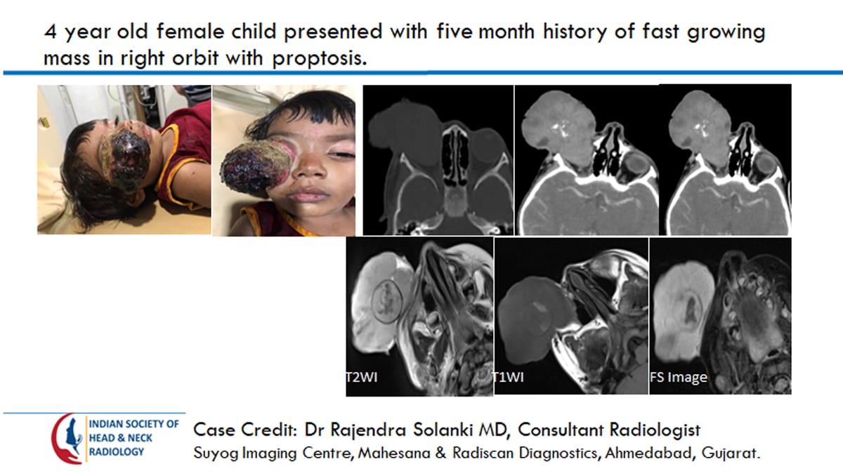 ISHNR Case of the Week