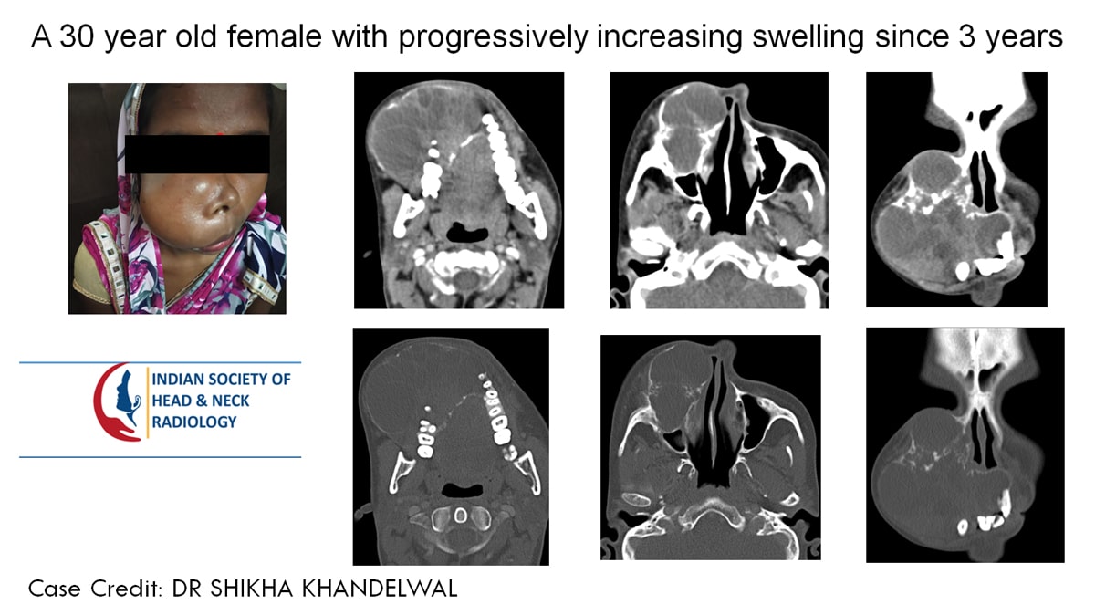 ISHNR Case of the Week