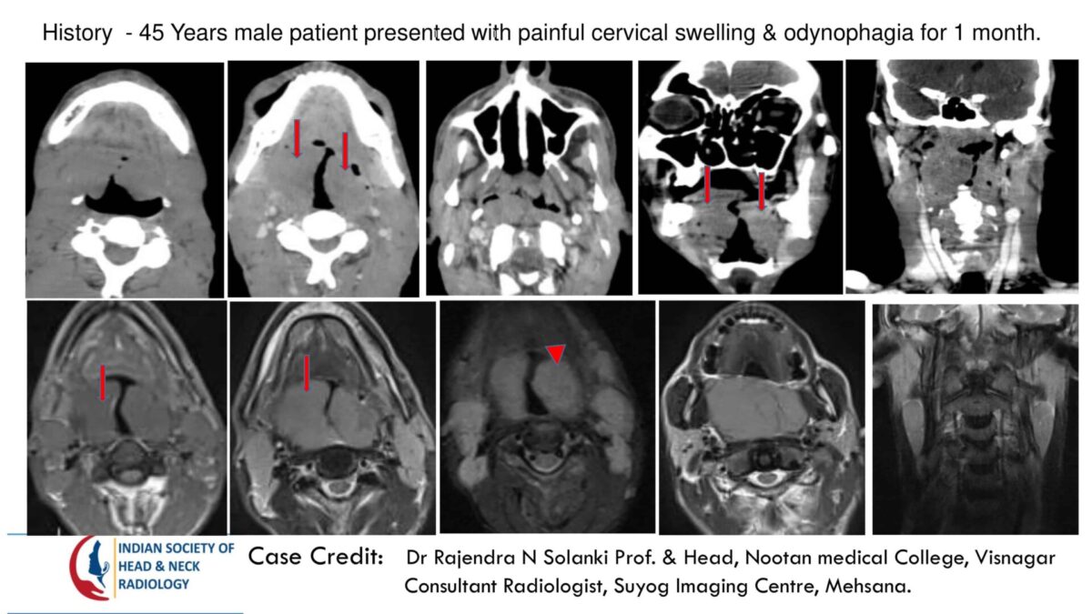 ISHNR Case of the Week