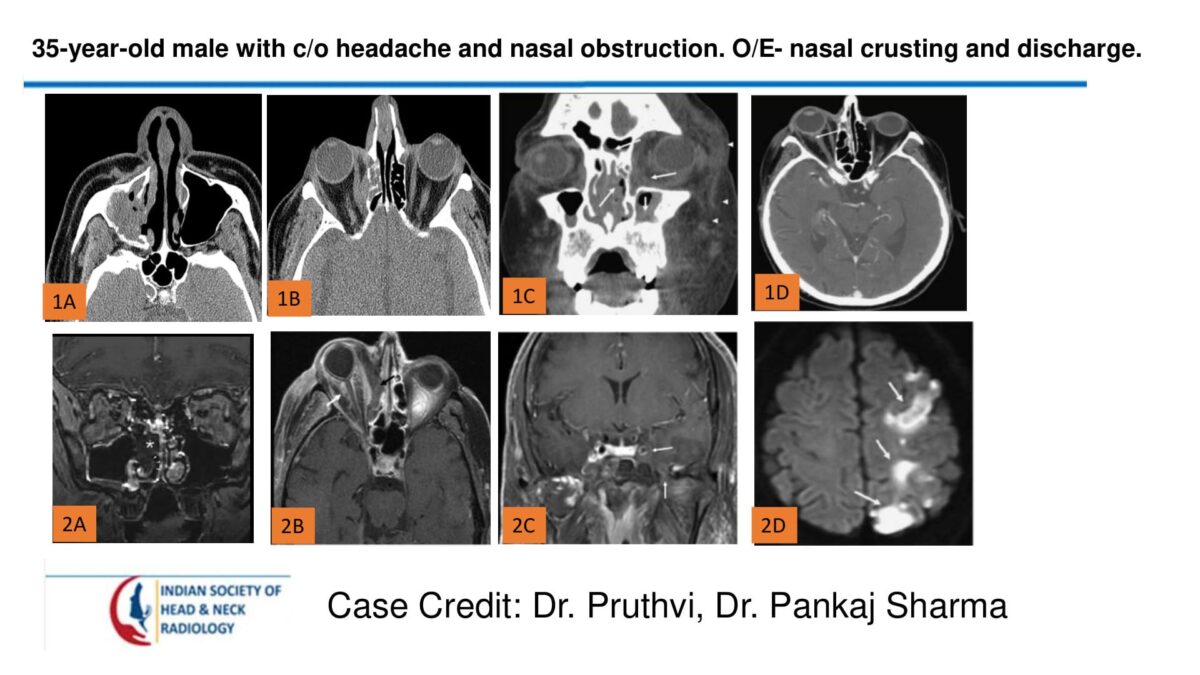 ISHNR Case of the Week