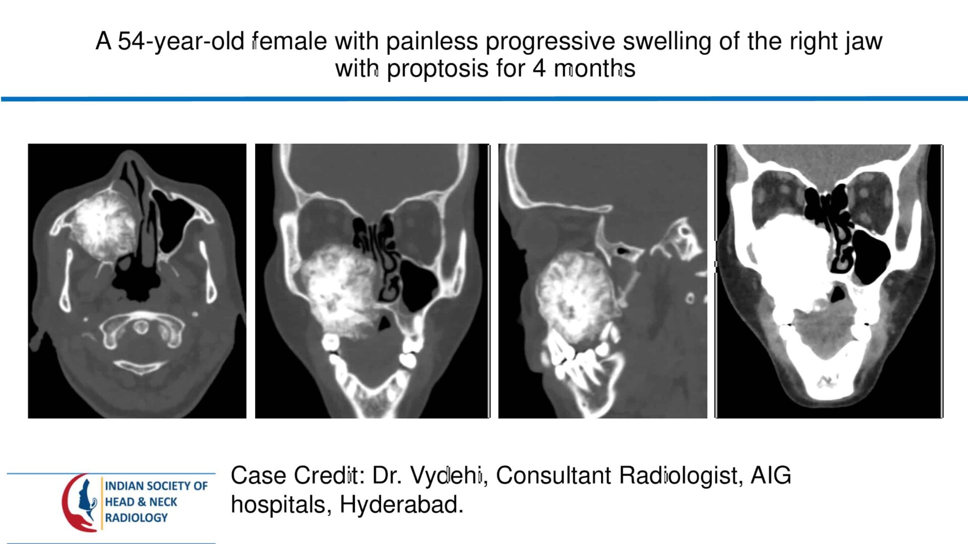 ISHNR Case of the Week