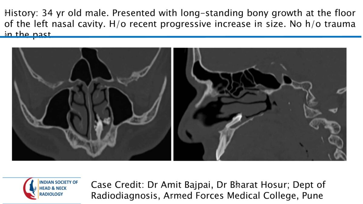 ISHNR Case of the Week