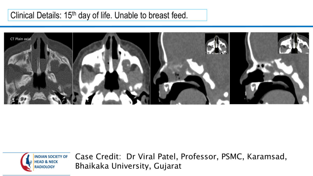 ISHNR Case of the Week