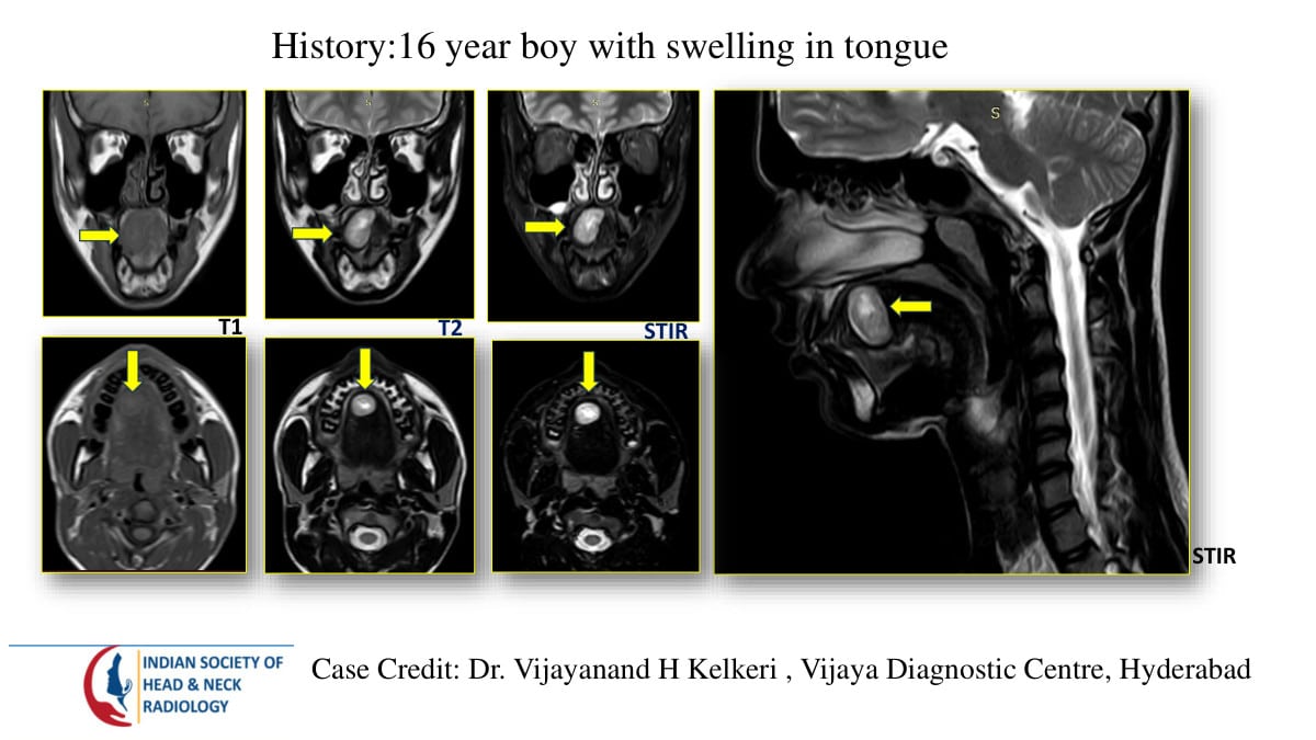 ISHNR Case of the Week
