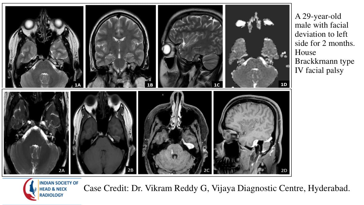 ISHNR Case of the Week