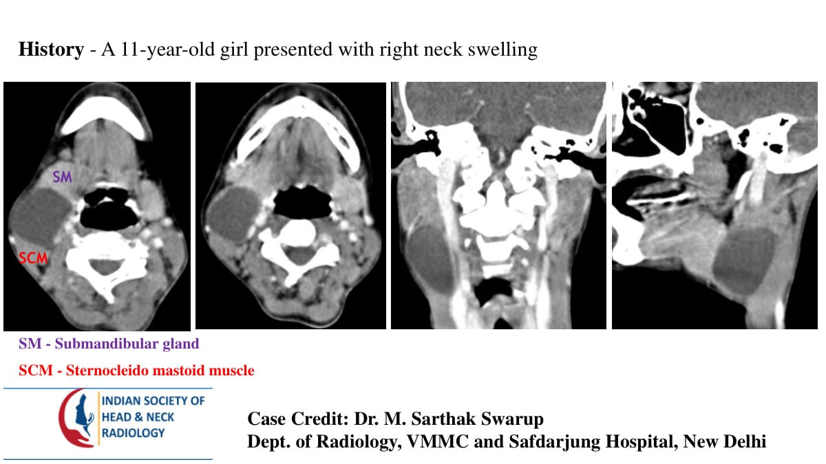 ISHNR Case of the Week