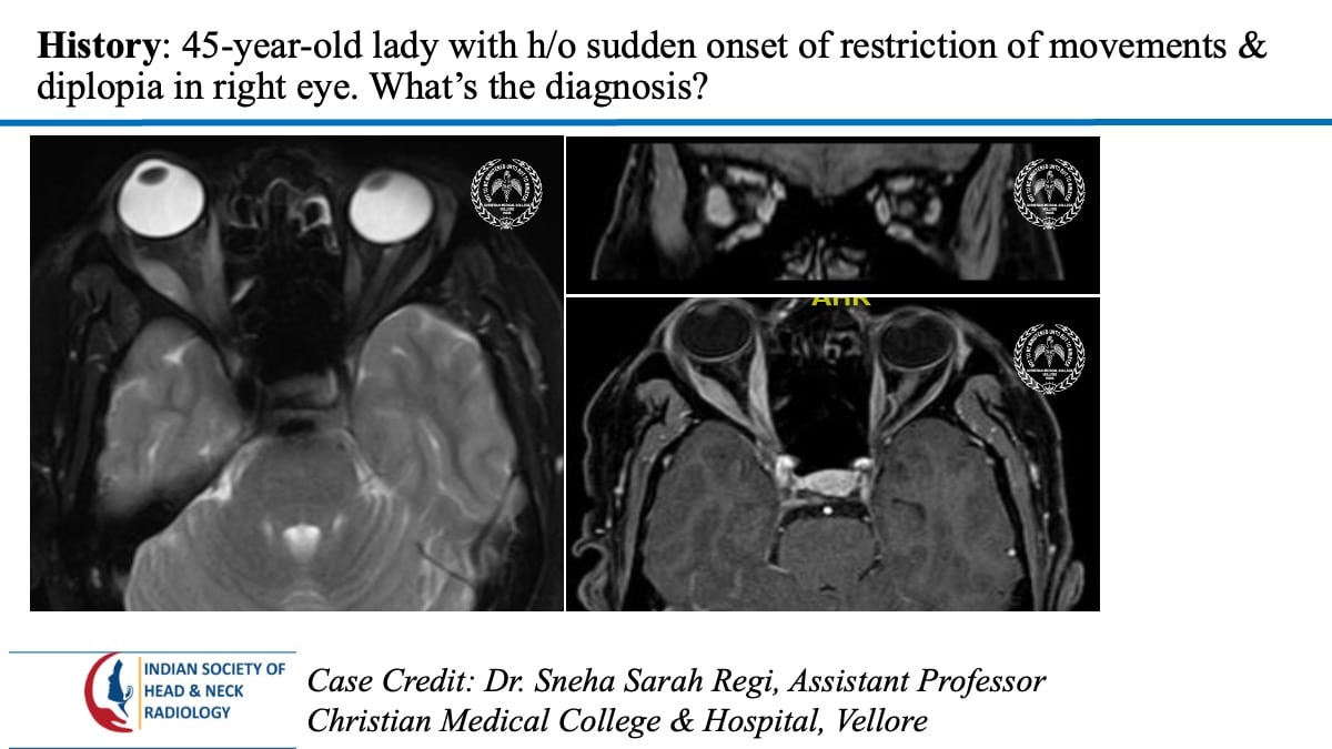 ISHNR Case of the Week