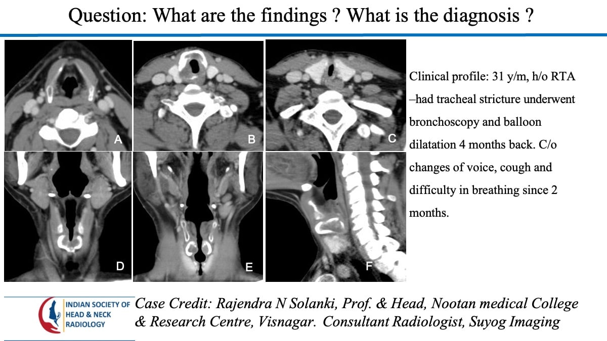 ISHNR Case of the Week