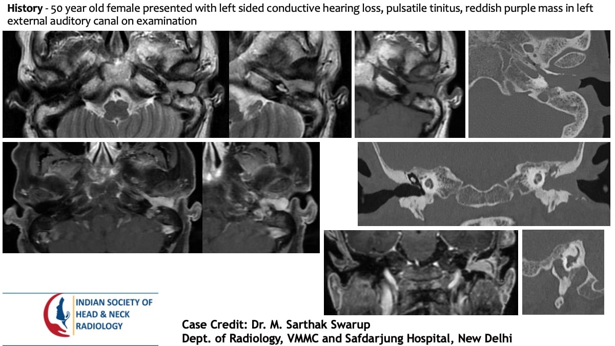 ISHNR Case of the Week
