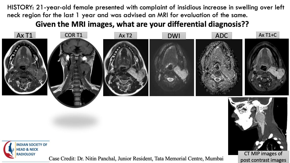 Case 104 - ISHNR