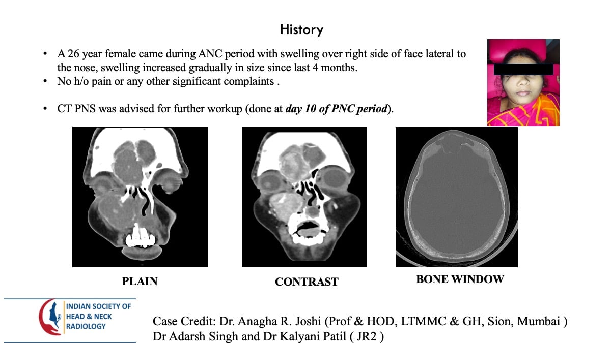Case 105 - ISHNR