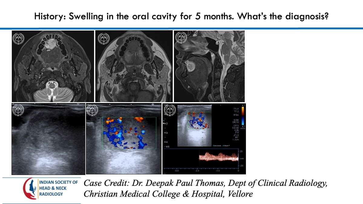 ISHNR Case of the Week