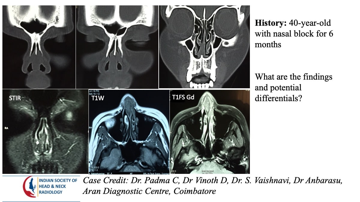 ISHNR Case of the Week