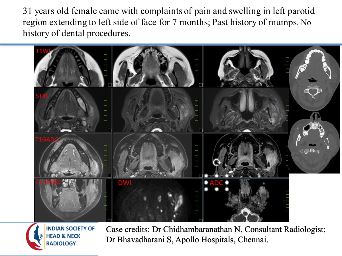 Case 124 - ISHNR